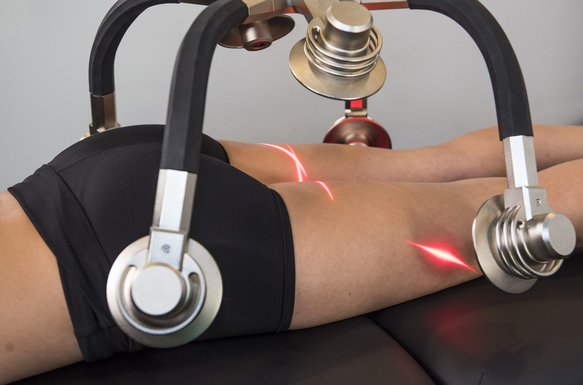Lymphatic Lifeline: Navigating Wellness with Zerona Cold Laser Therapy